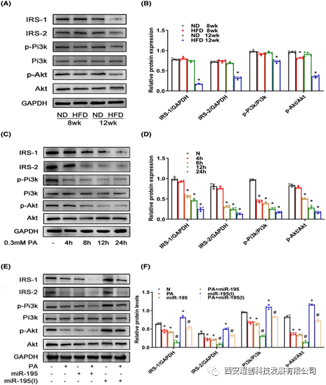 棕榈酸对Min6小鼠胰腺β细胞影响研究